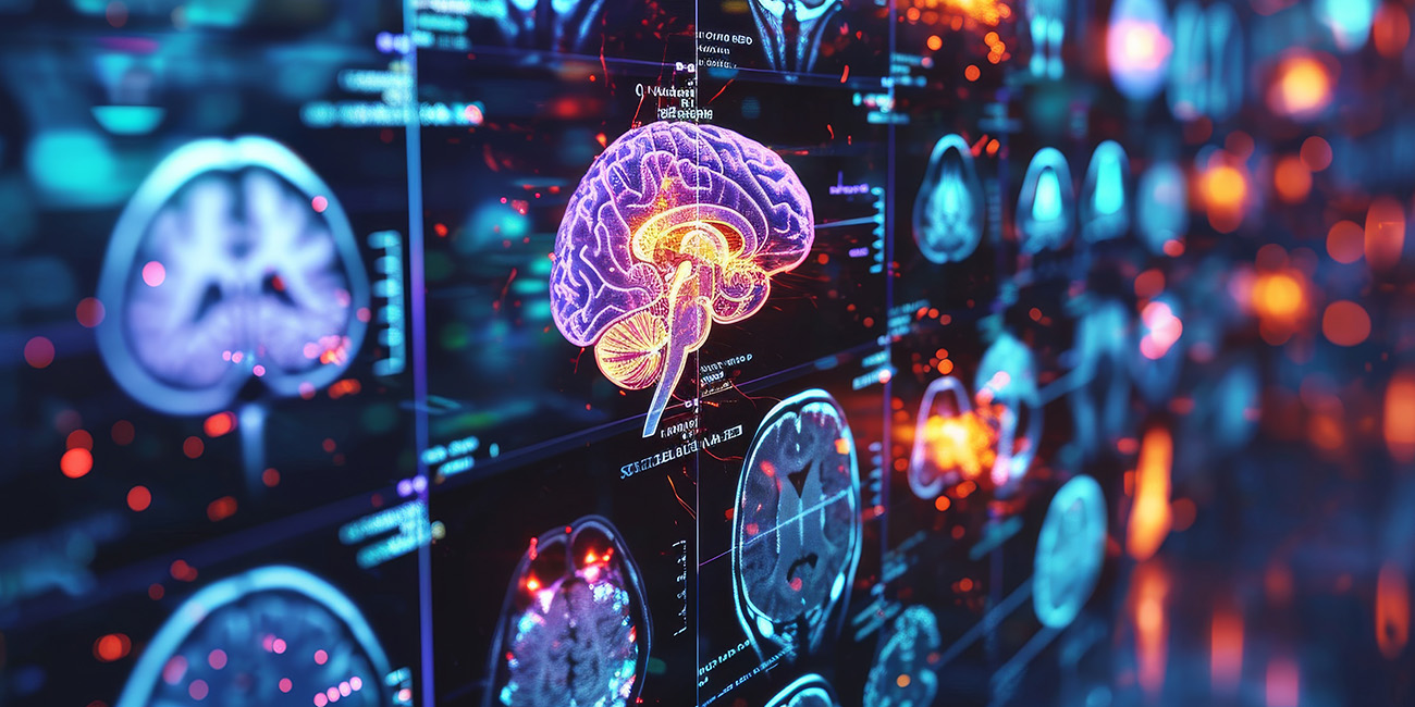 A Look At The Brain Disorder CTE